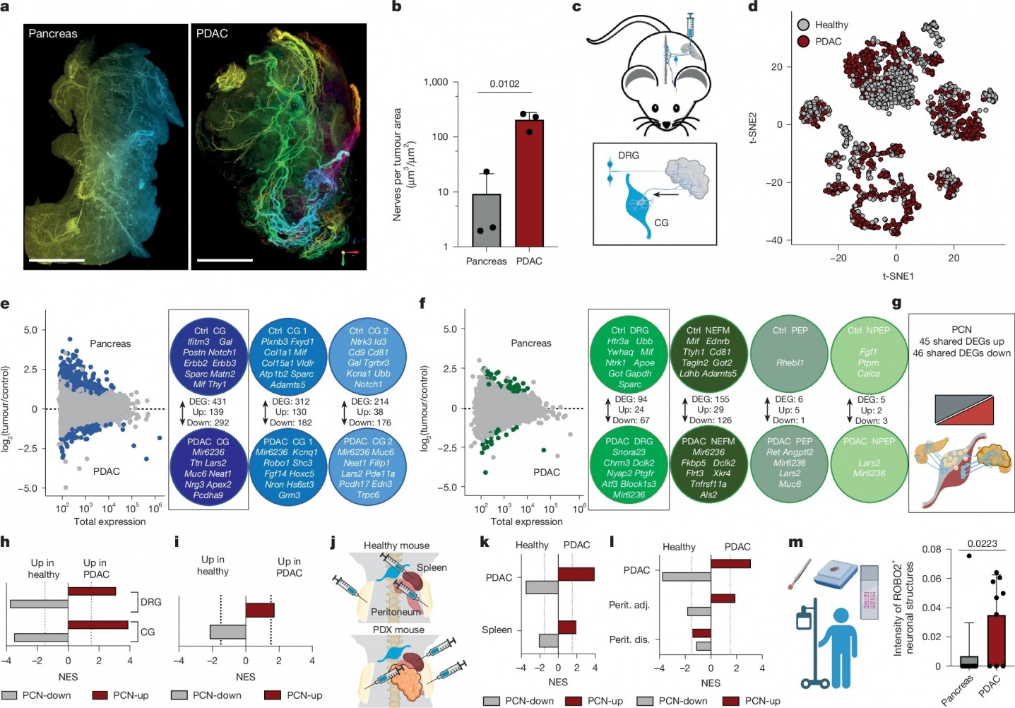 Characterization of single neurons reprogrammed by pancreatic cancer